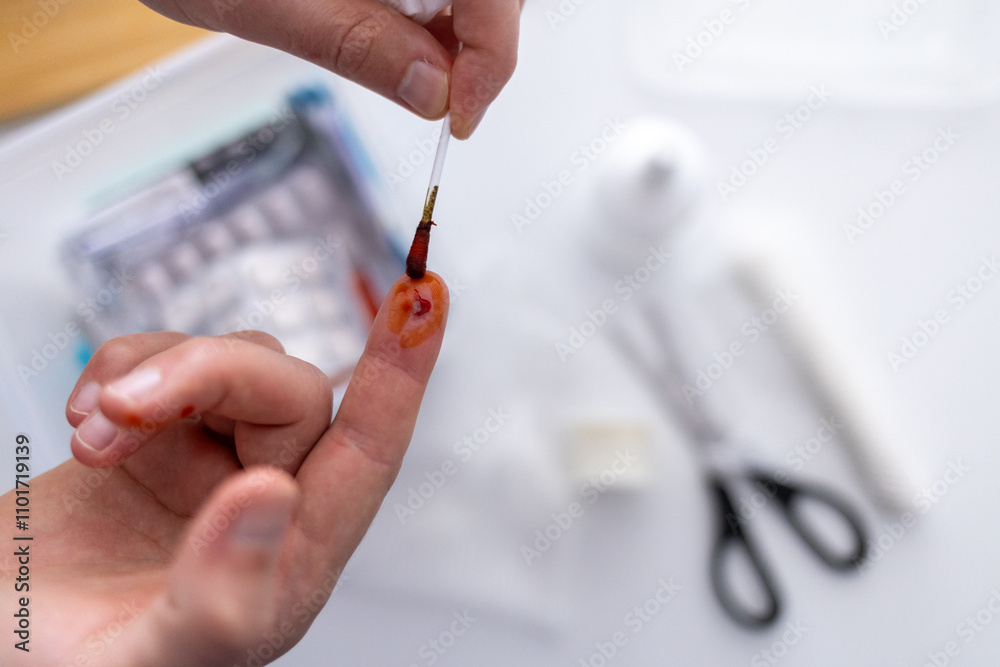 concept of first aid for cuts and injuries. knife cut in the kitchen ...