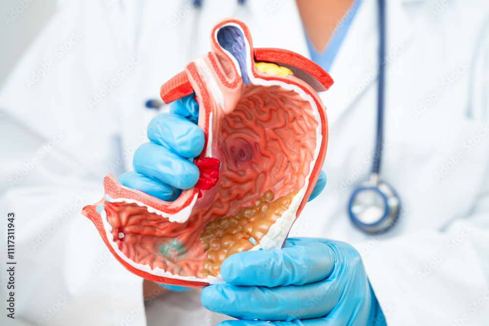 Stomach disease, doctor holding anatomy model for study diagnosis and ...