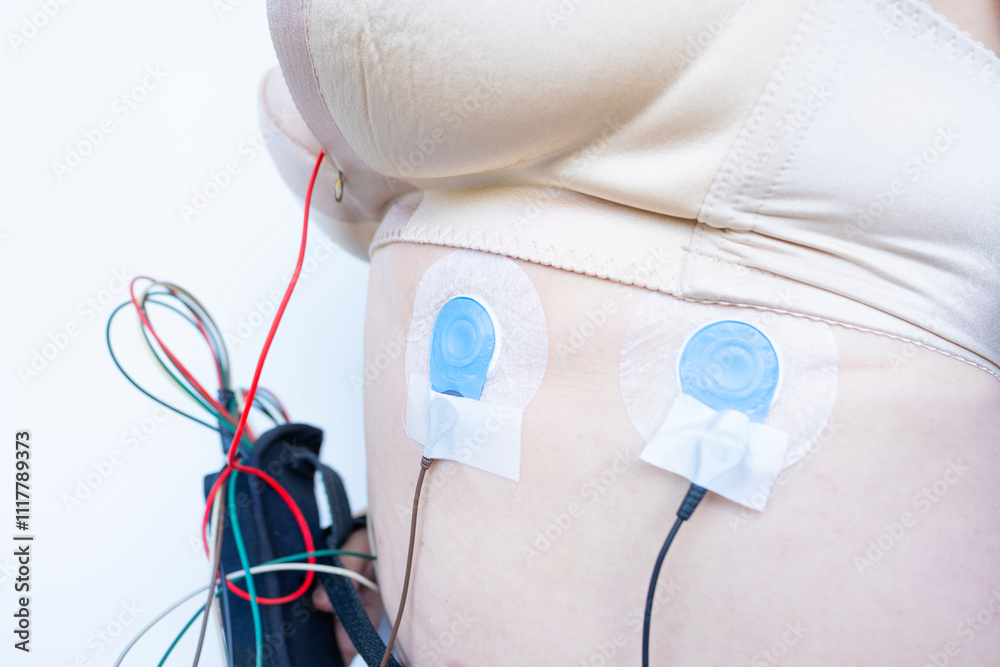 sensors on female body for Holter monitoring, woman with Holter monitor ...
