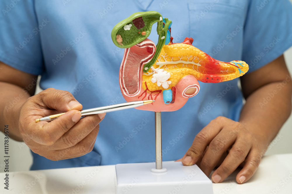 Pancreatitis, pancreatic cancer, Asian doctor with pancreas ...