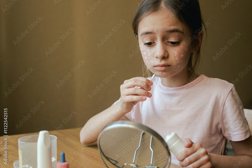 Teen girl with a rash on her face applies cream to her skin in front of ...