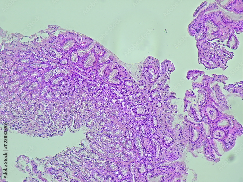 Foto de Stock Human cell tissue under microscope in pathology ...