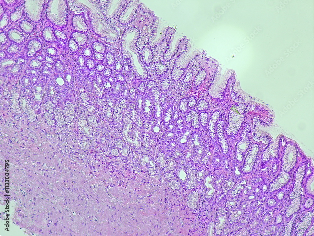 Human cell tissue under microscope in pathology laboratory. Microscopic ...