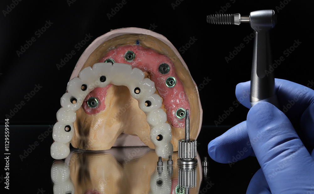 Full-arch dental prosthesis torque wrench and dental implant wrench ...