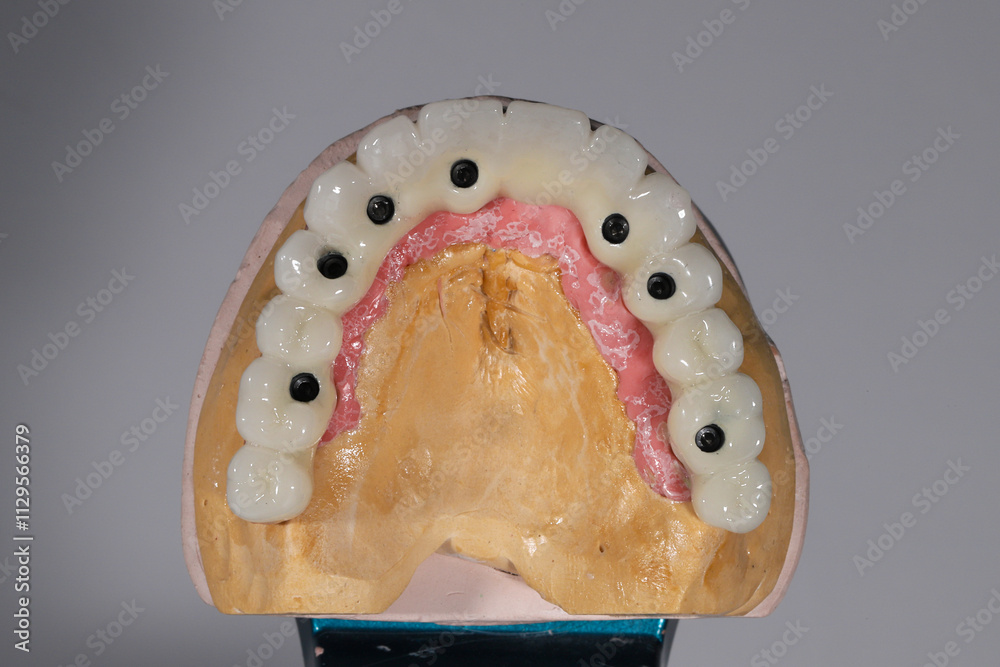 Full-arch dental prosthesis torque wrench and dental implant wrench ...