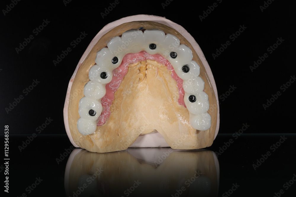 Full-arch dental prosthesis torque wrench and dental implant wrench ...