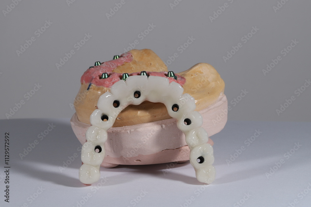 Full-arch dental prosthesis torque wrench and dental implant wrench ...