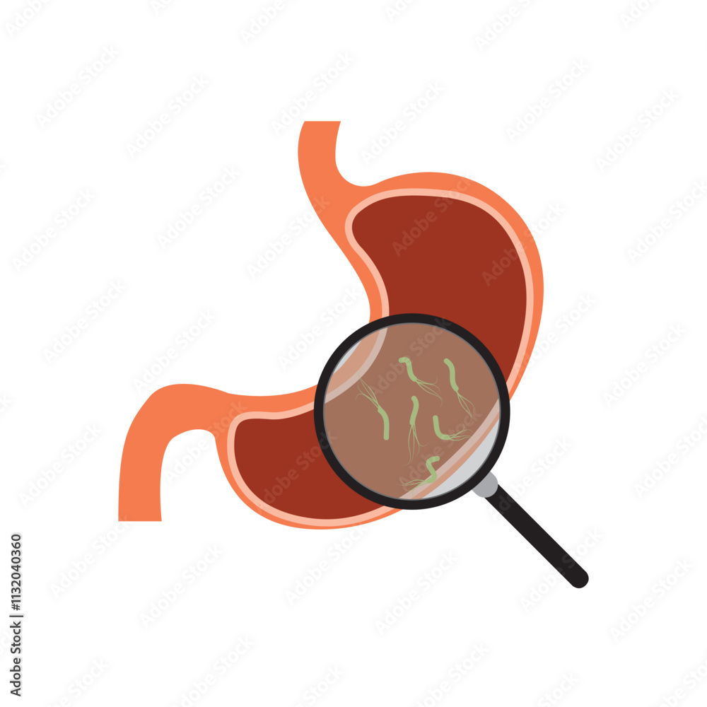 Helicobacter Pylori in the stomach. Stomach diseases. Bacterium with ...