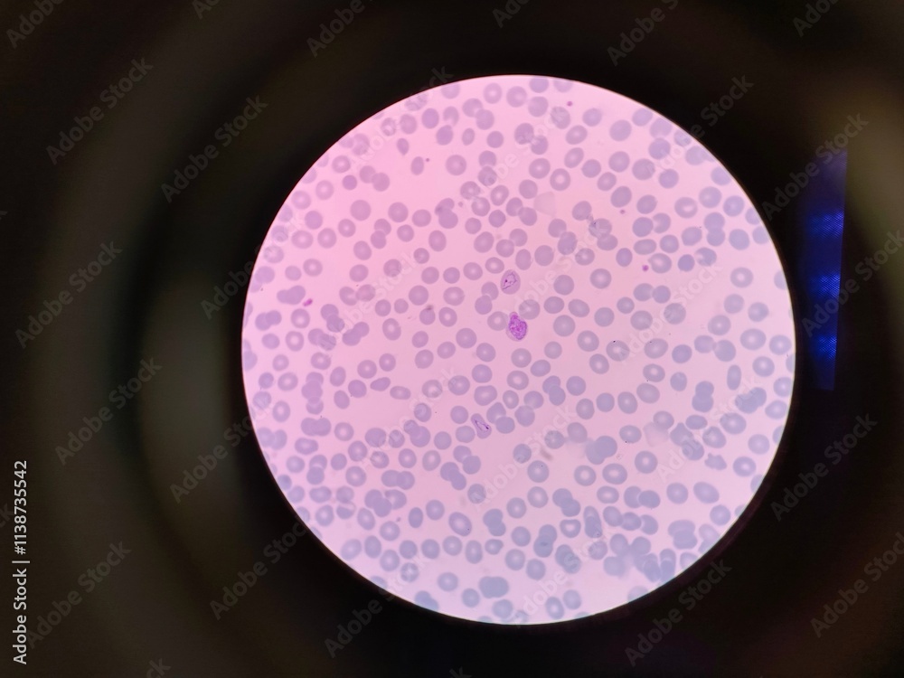 Plasmodium vivax is a protozoal parasite and a human pathogen. This ...
