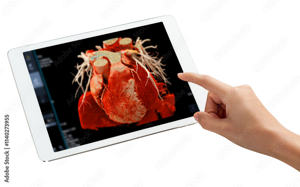 The tablet screen highlights a realistic coronary CTA image, with a ...