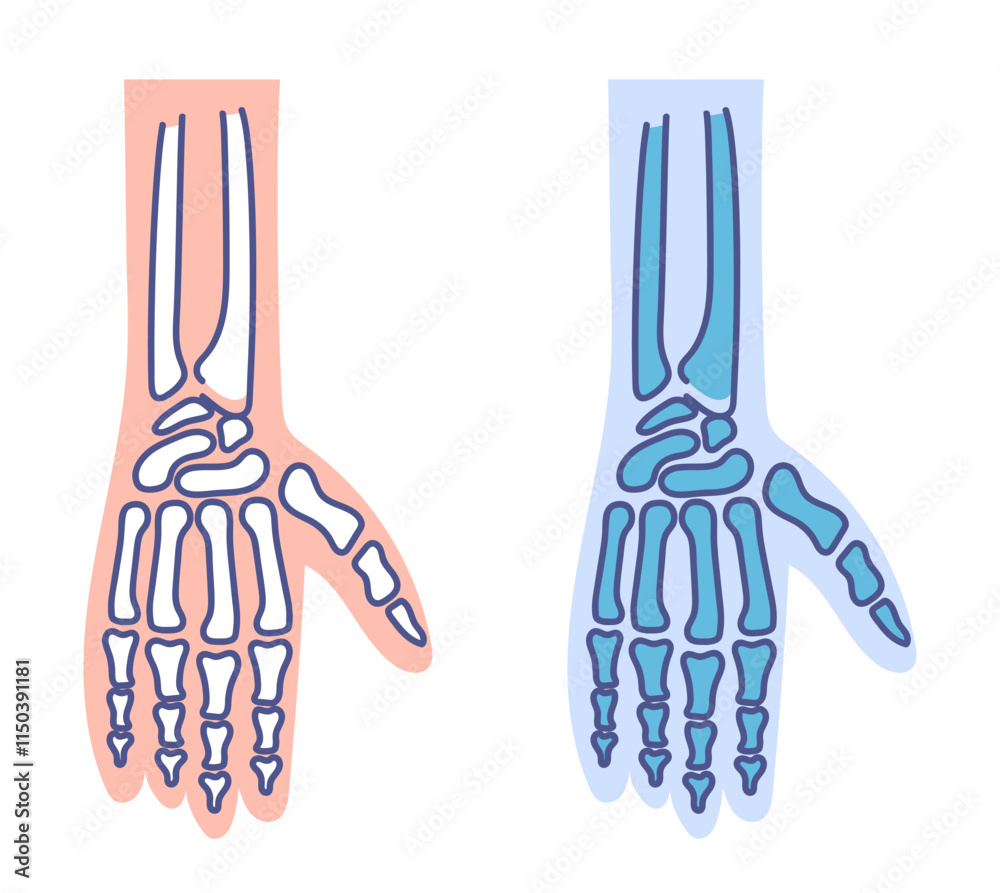 Hand arm x ray radiography medicine concept. Vector flat graphic design ...