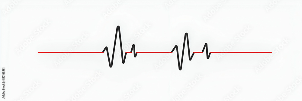 ECG Waveform, Irregular Heartbeat Pattern Analysis, showing variations ...