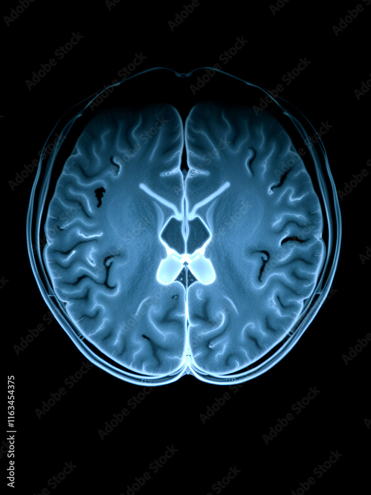 Brain sectional imaging X-ray and CT scan technique, cyborg radiography ...