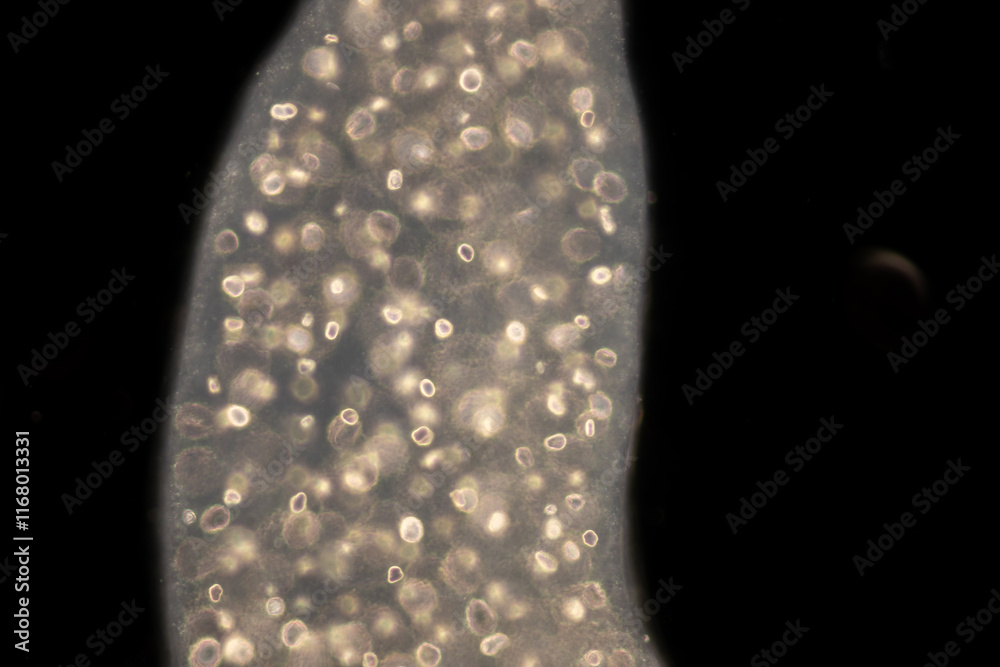 Cyctacanth stage (Acanthocephala) fish cestode larva (Trianchoratus sp ...