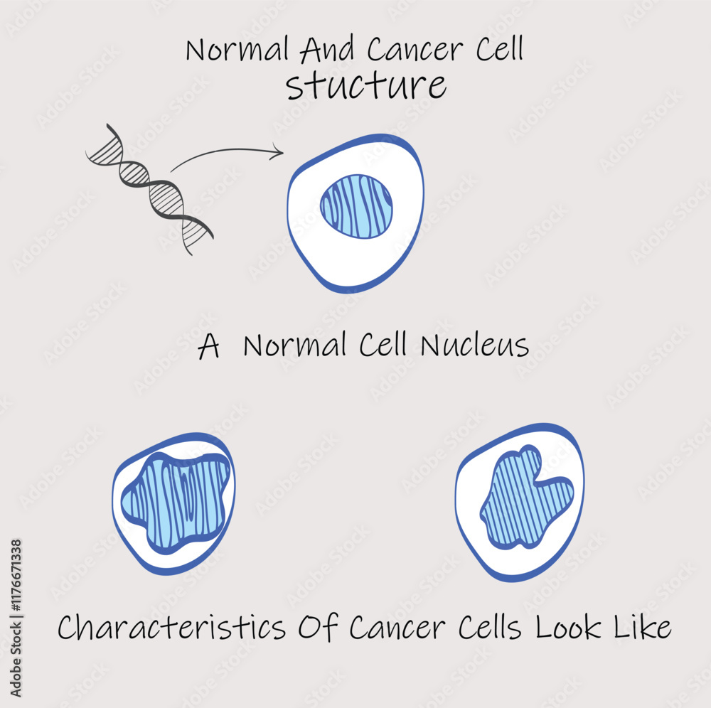 Normal and Cancer Cell Structure Illustration, Detailed Diagram of Cell ...