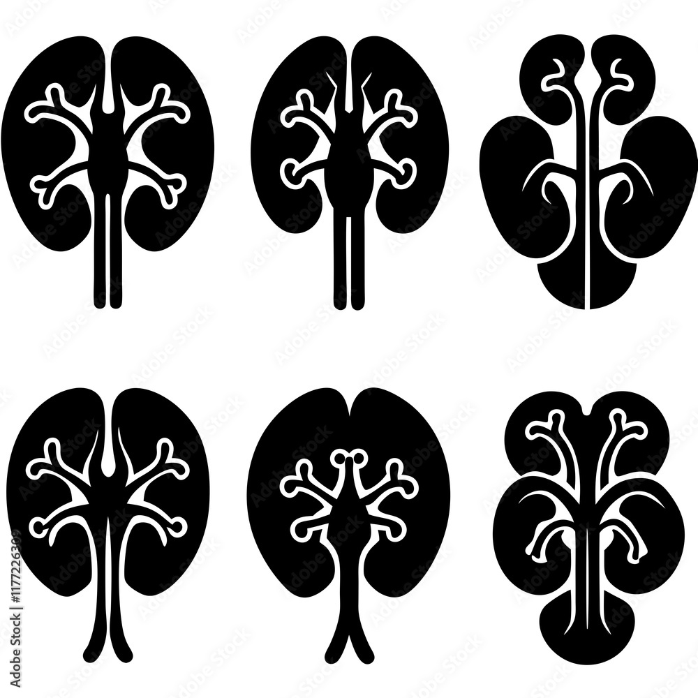 Variations of Kidney Anatomy Diagrams Stock Vector | Adobe Stock