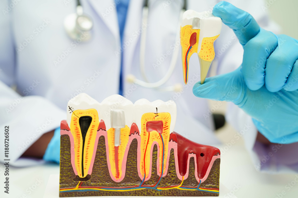 Dentist holding dental implant, artificial tooth roots into jaw, root ...
