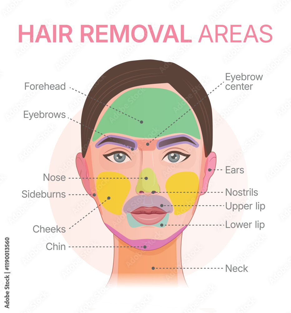 Face epilationVector diagram showing facial hair removal areas ...
