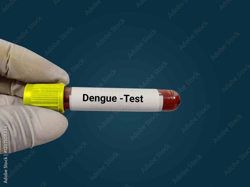 Test Tube with blood sample for dengue virus test. Doctor's hand hold ...
