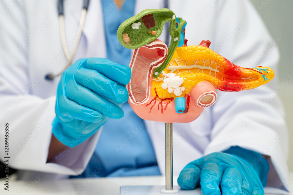 Pancreatitis, pancreatic cancer, Asian doctor with pancreas ...