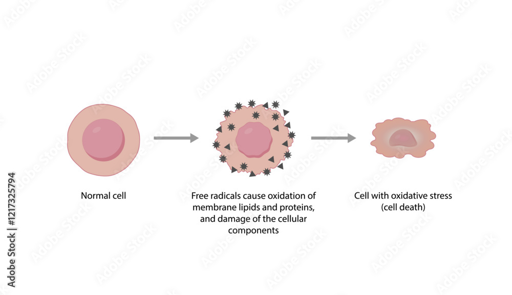 Oxidative stress. Free radicals cause oxidation of the cellular ...