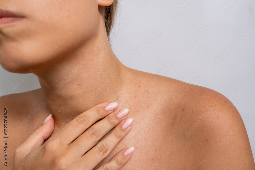 Red rash under jaw. Young woman touching her neck with hands showing ...