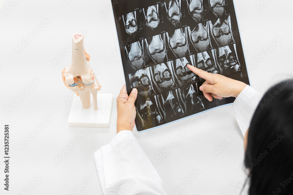 Doctor holding patient bone x-ray film before surgery.Image MRI and CT ...