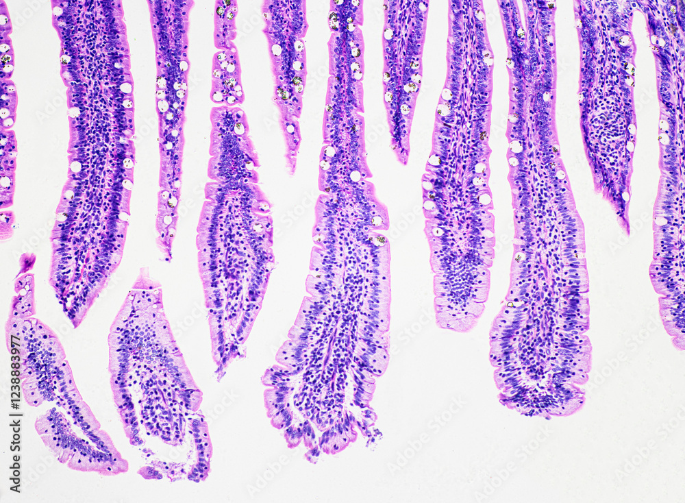 This is a histological photograph of the human small intestine ...