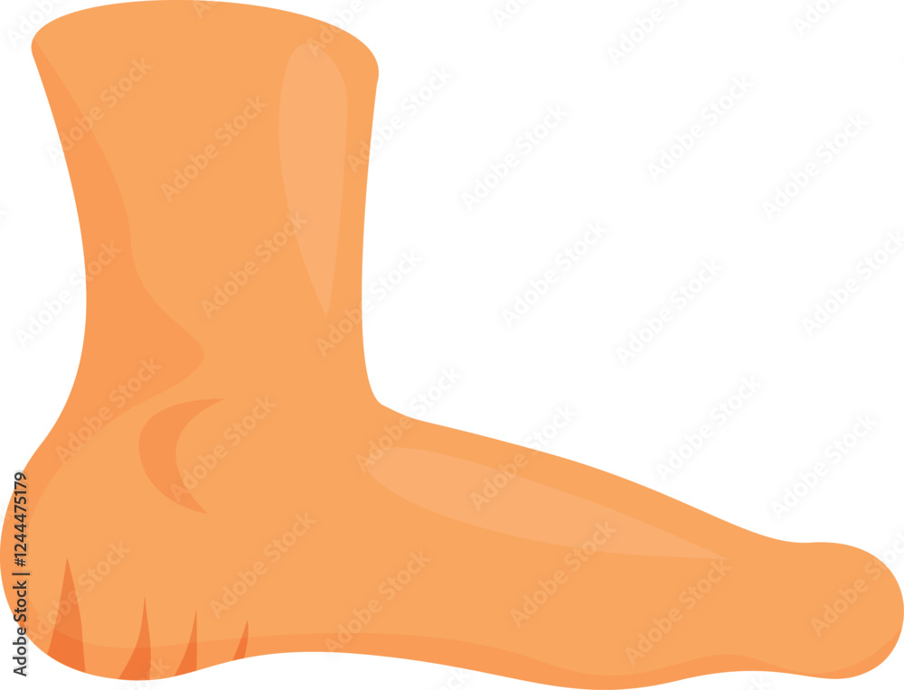 Side view of a human foot with dry cracked heel skin, indicating a need ...