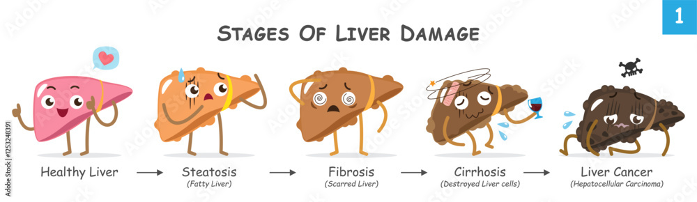 Stages of liver damage . Collection of cute medical cartoon characters ...