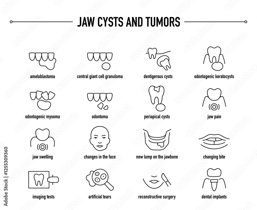Jaw Cysts and Tumours symptoms, diagnostic and treatment vector icon ...