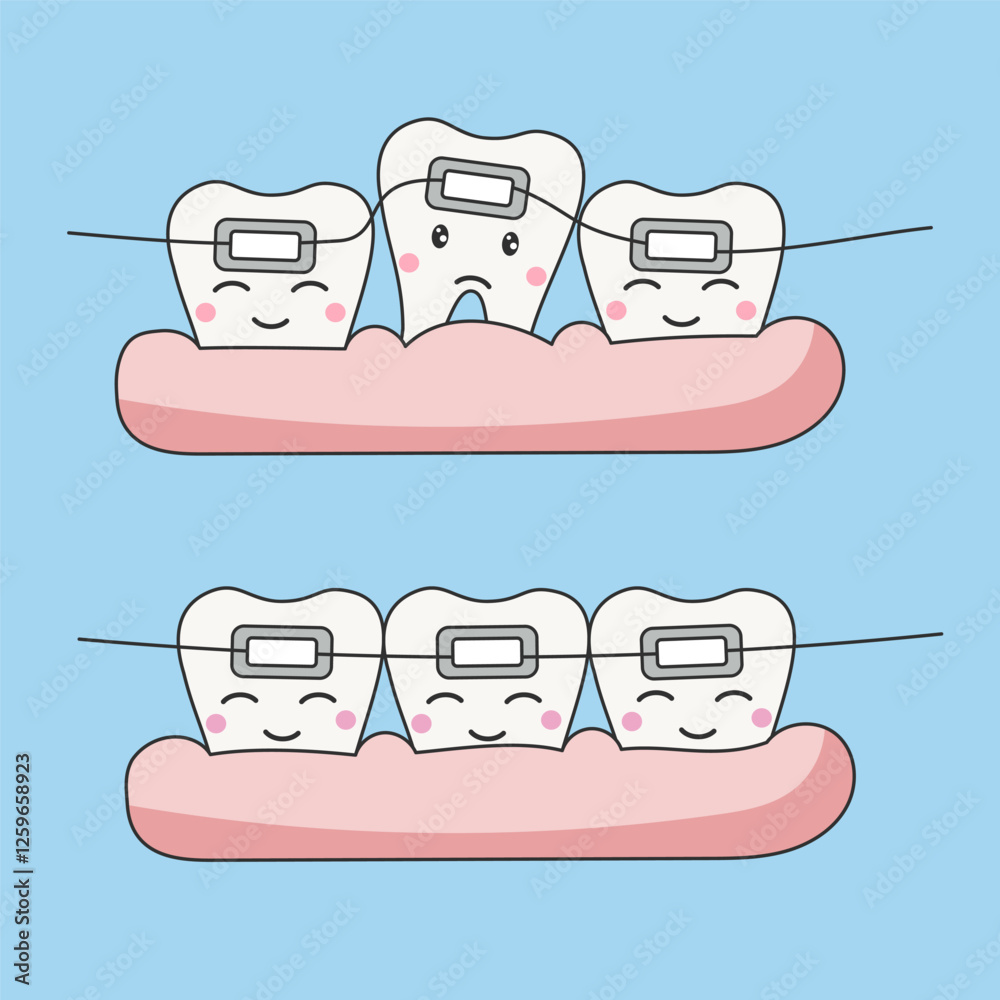 Cute tooth brace character. Teeth care and treatment concept. Smiling ...