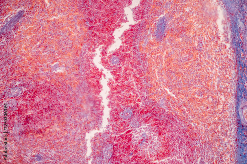 Showing Light micrograph of the Adrenal gland, Spleen human and Other ...