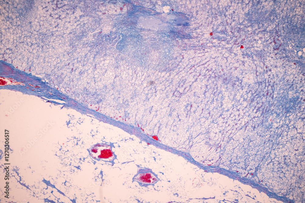 Showing Light micrograph of the Adrenal gland, Spleen human and Other ...