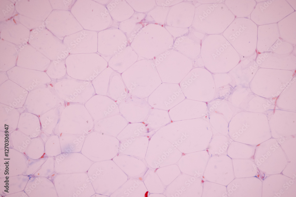 Showing Light micrograph of the Adrenal gland, Spleen human and Other ...