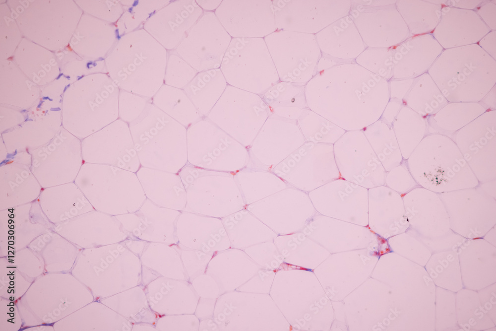 Showing Light micrograph of the Adrenal gland, Spleen human and Other ...