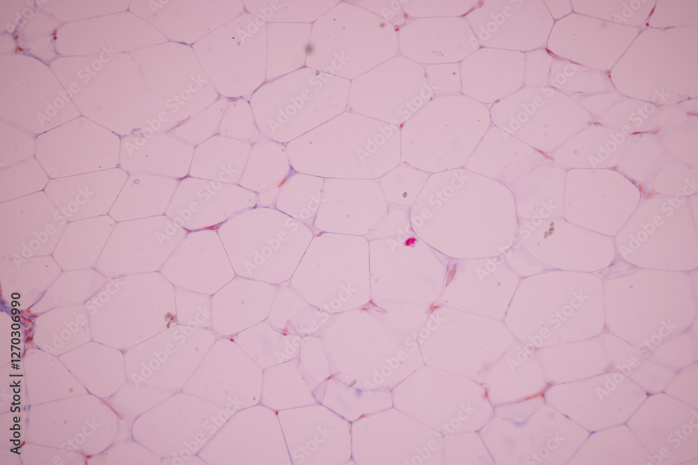 Showing Light micrograph of the Adrenal gland, Spleen human and Other ...