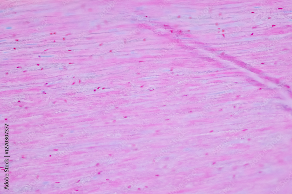 Showing Light micrograph of the Adrenal gland, Spleen human and Other ...