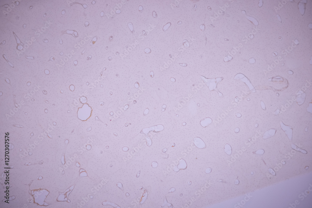 Showing Light micrograph of the Adrenal gland, Spleen human and Other ...