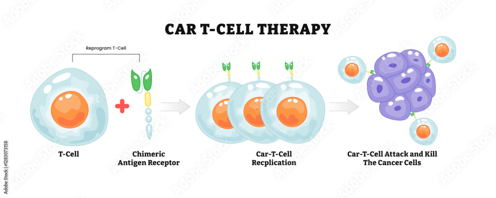 Car T-cell Therapy process diagram, healthcare poster design, cancer immunotherapy. killing of ...