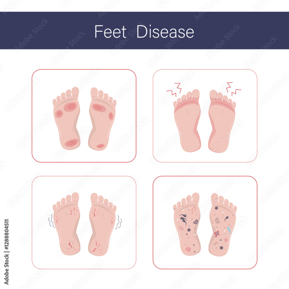 Dirty human bare foot, various microorganisms and bacterias on feet ...