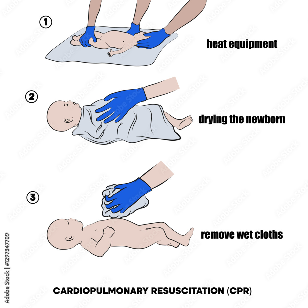 Drying the newborn first steps before cpr Stock Vector | Adobe Stock