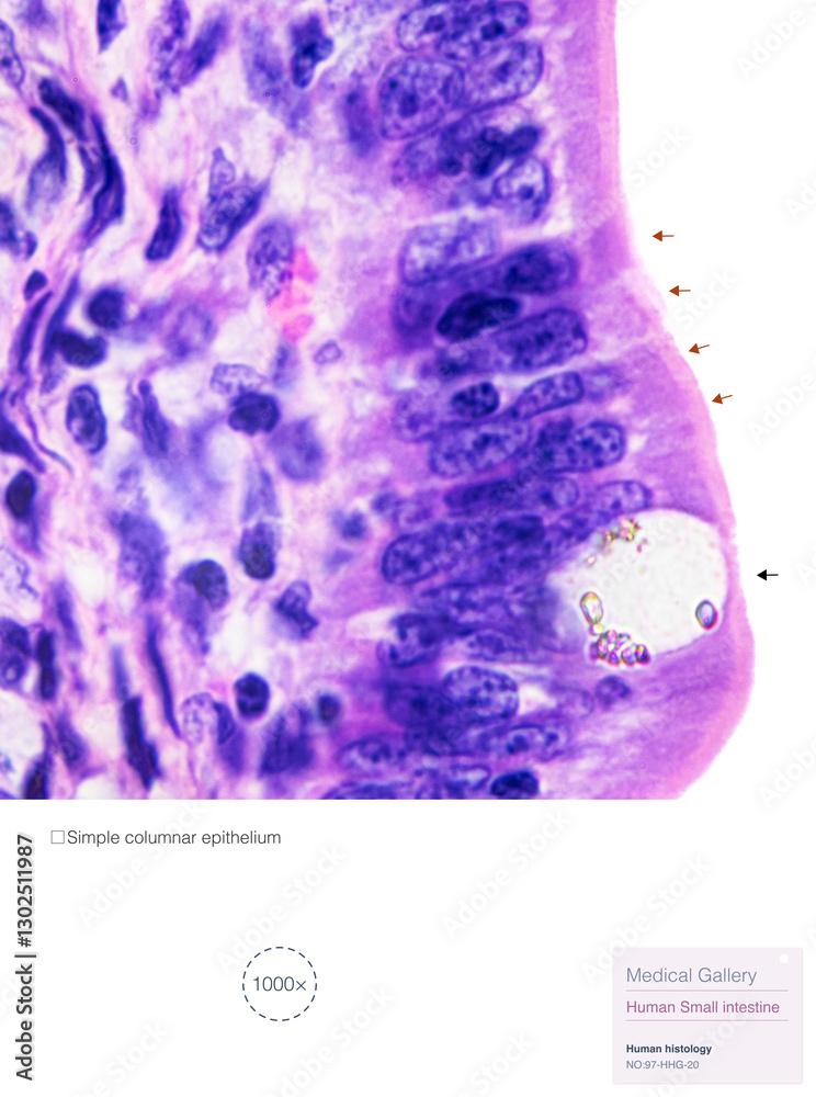 This is a histological photograph of the human small intestine, which ...