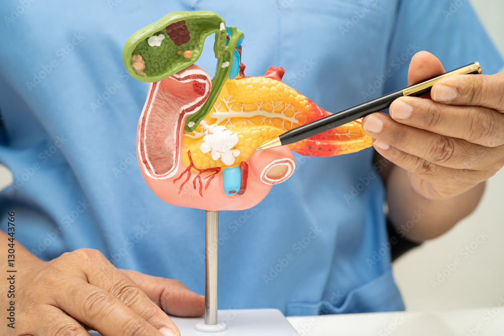 Pancreatitis, pancreatic cancer, Asian doctor with pancreas ...