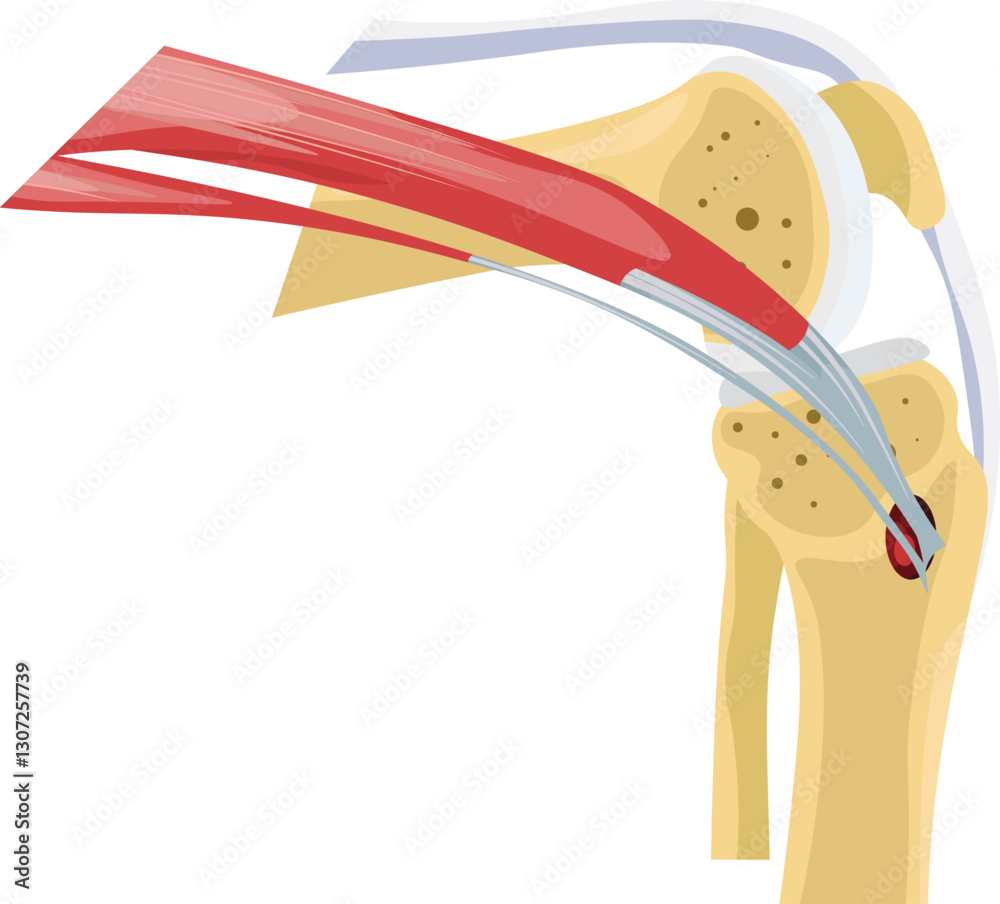 pes anserine bursitis knee pain vector Stock Vector | Adobe Stock