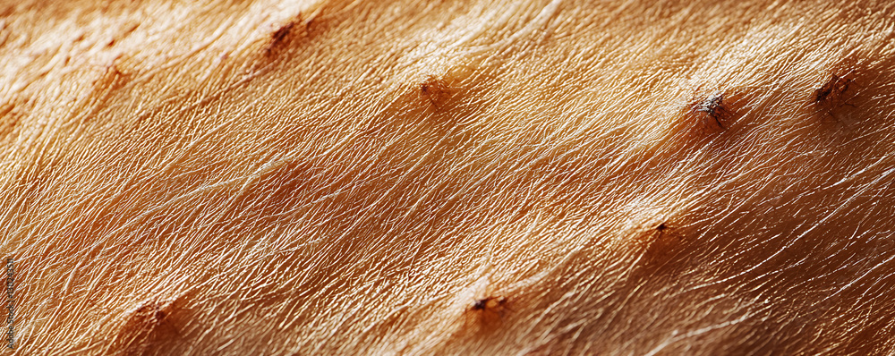 A detailed macro photograph of human skin showing a rough irritated ...