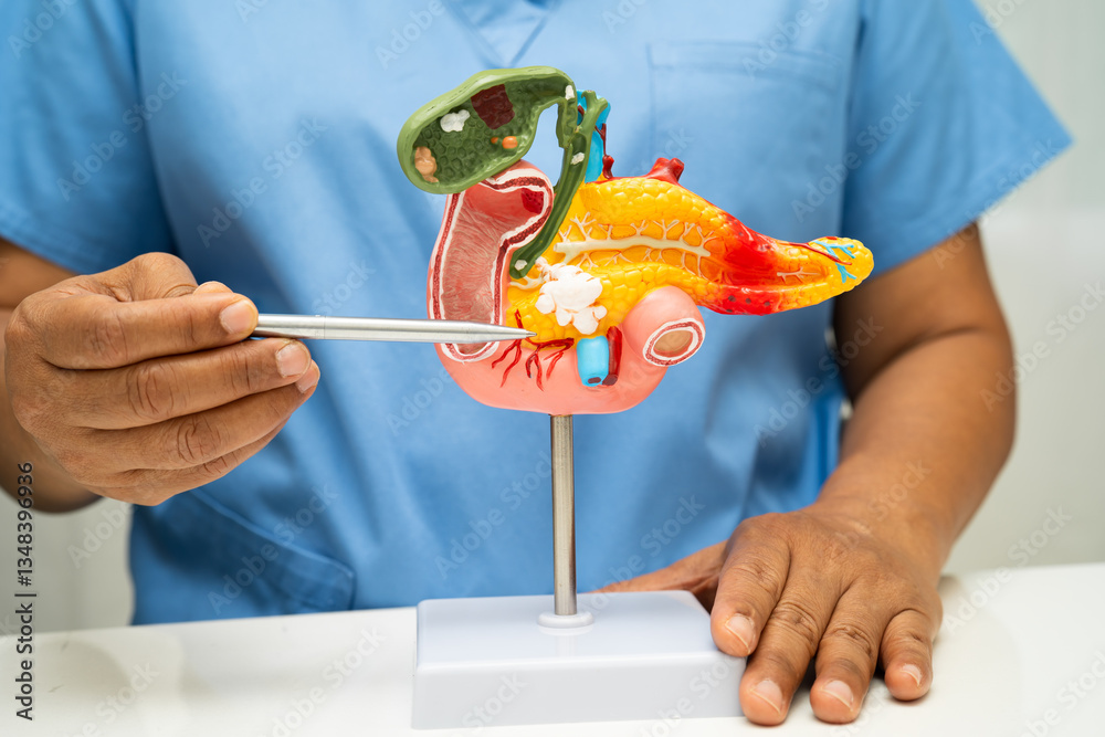 Pancreatitis, pancreatic cancer, Asian doctor with pancreas ...