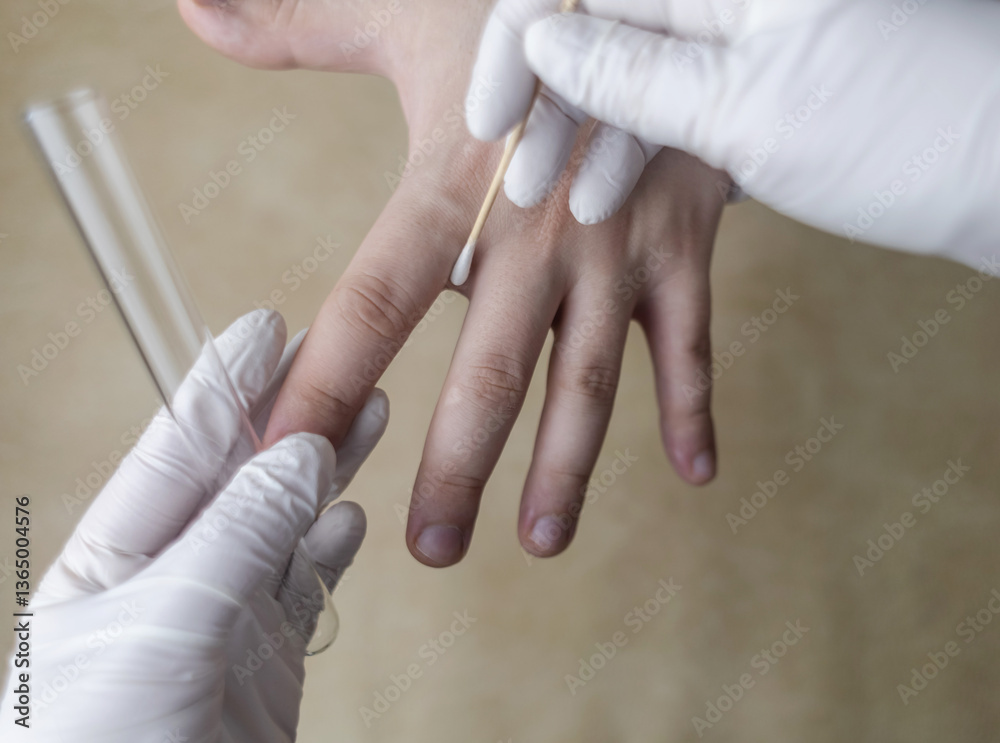 Dermatologist collects skin swab sample from patient's arm using cotton ...