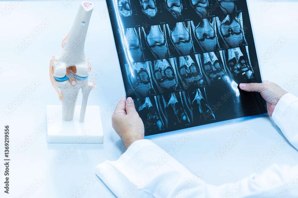 Doctor holding patient bone x-ray film before surgery.Image MRI and CT ...