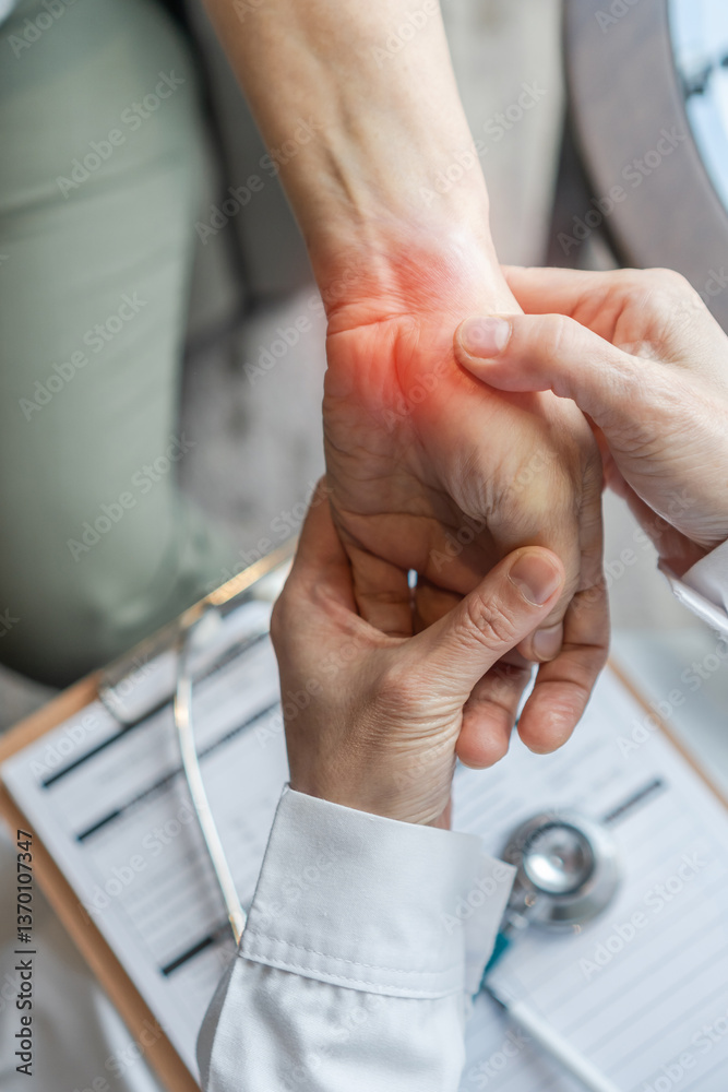 Carpal tunnel syndrome (CTS) pressure on nerve; Osteoarthritis ...